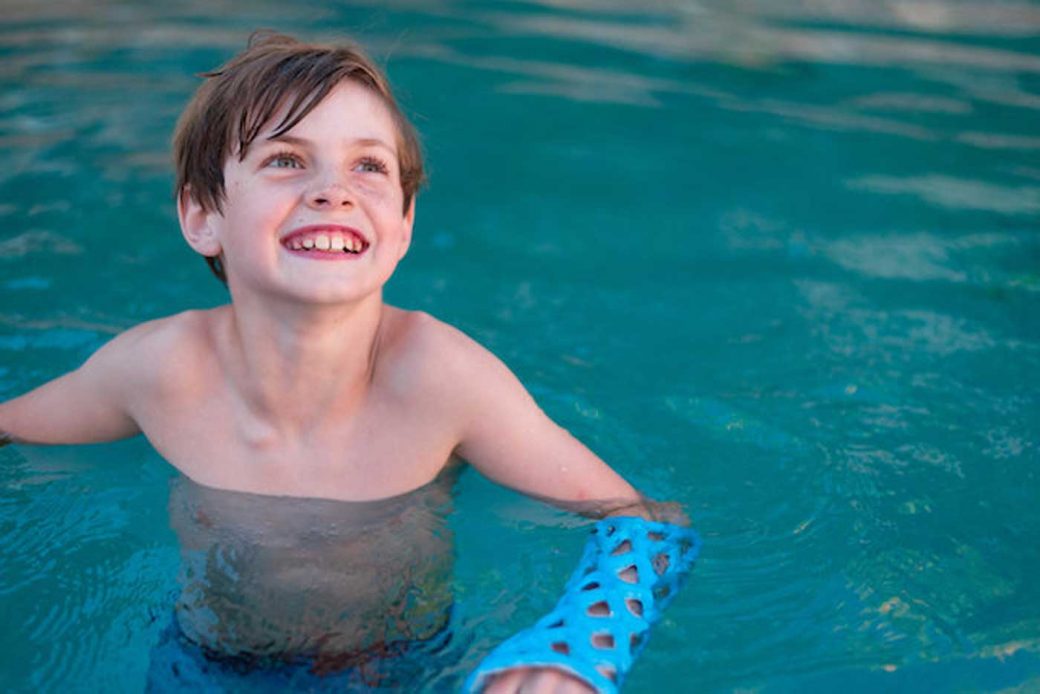 Revolutionary new orthopaedic cast is lightweight, waterproof and ...