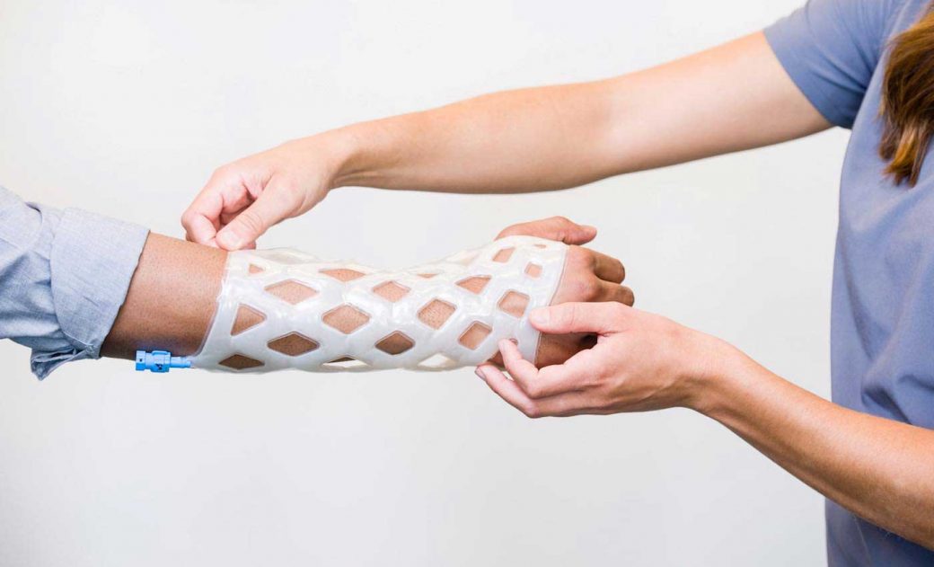 Revolutionary new orthopaedic cast is lightweight, waterproof and ...