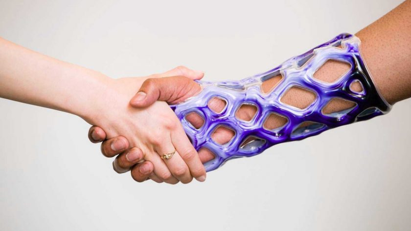 Revolutionary new orthopaedic cast is lightweight, waterproof and ...